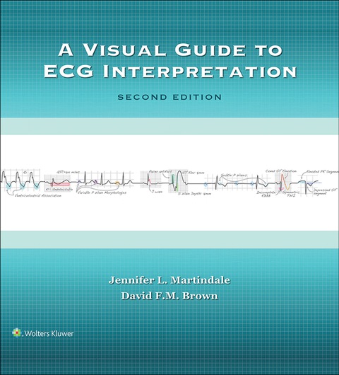 A Visual Guide to ECG Interpretation 2nd Edition – PDF/EPUB Version ... A Visual Guide to ECG Interpretation 2nd Edition – PDF/EPUB Version ...