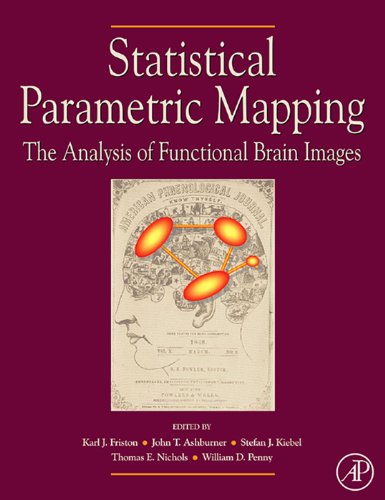 Statistical Parametric Mapping: The Analysis of Functional Brain Images – PDF/EPUB Version ...